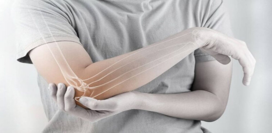 Entezopatia - úrazy a ochorenia šľachových úponov. - HillVital