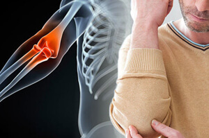 Entezopatia - úrazy a ochorenia šľachových úponov. - HillVital